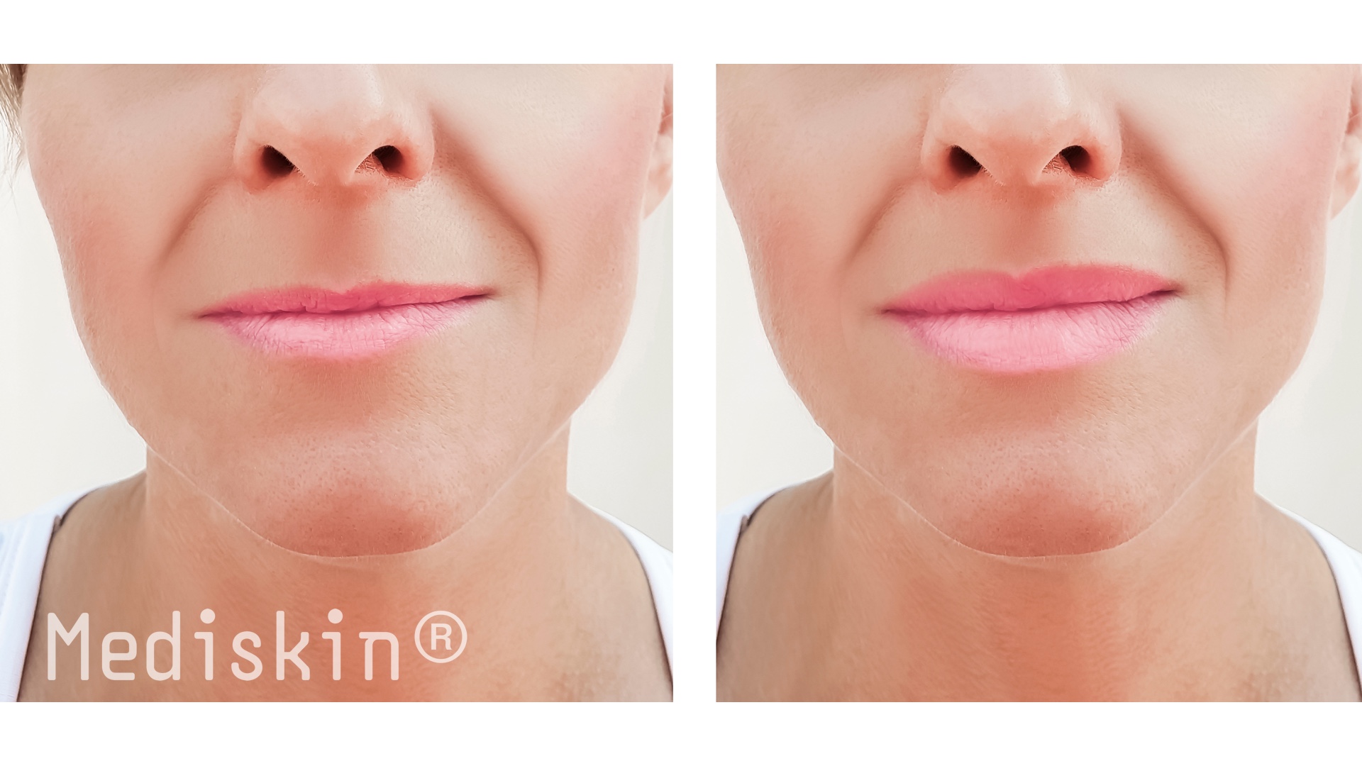 Mediskin (29)-web – Mediskin