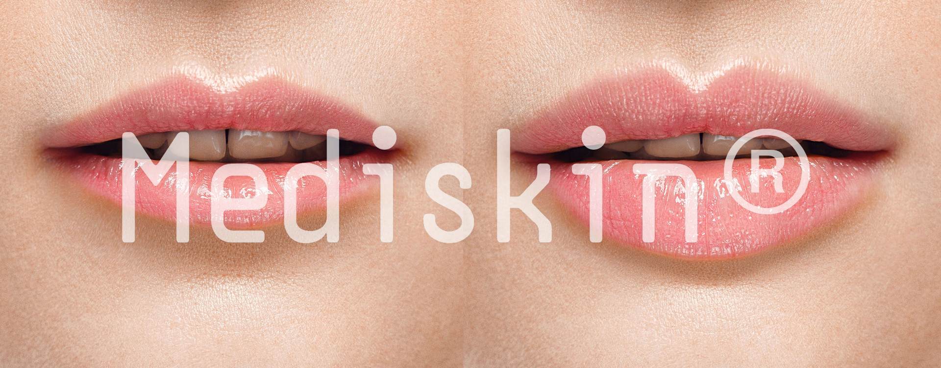 Mediskin (4) – Mediskin